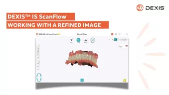 How-To Videos | DEXIS